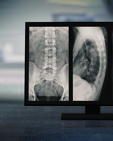 How an RCSI innovation revolutionised the teaching of anatomy - Royal ...